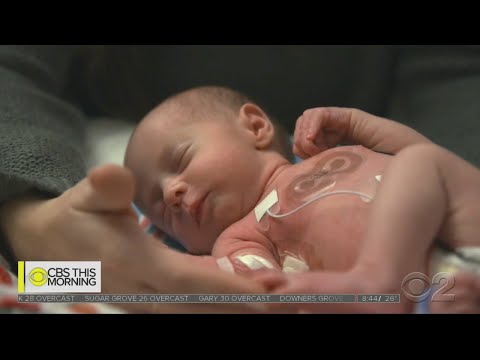 Tiny New Sensors Could Revolutionize Neonatal Intensive Care Units
