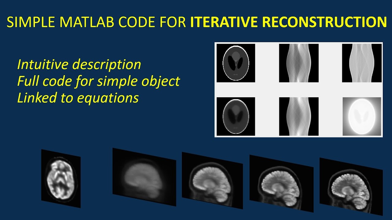Simple code for iterative image reconstruction (see https://youtu.be/IhETD4nSJec for PYTHON version)