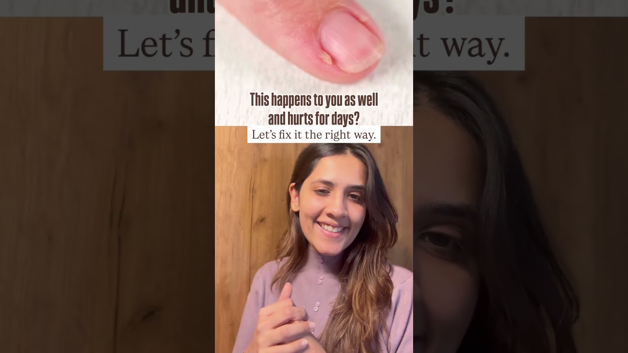 #Hangnails - your #dermatologist helps you with it. Read the description 👇🏻