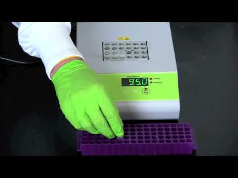 Alu PV92 Detection by PCR