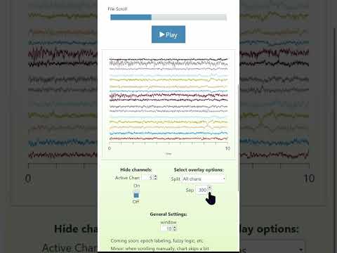 Quick EEG Review