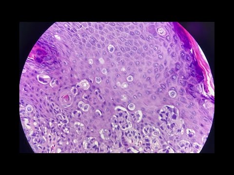 Case 16 | Pathologists Online