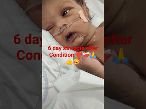 6 day is very critical condition baby life after condition ❤️🩹👍🙏#meditation #knowledgeable
