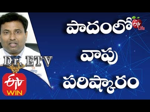 పాదంలో వాపు పరిష్కారం | డాక్టర్ ఈటీవీ | 20th మార్చి 2020 | ఈటీవీ లైఫ్