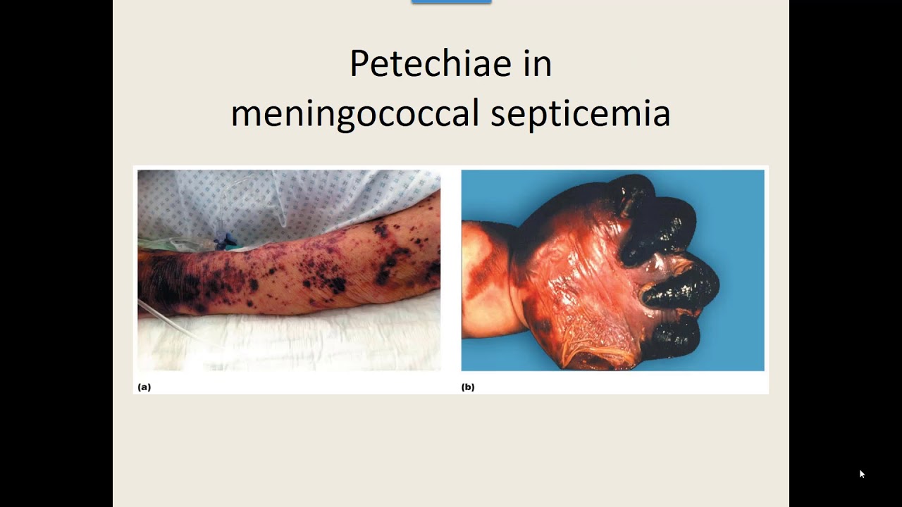 Gram Negative Intro PPT