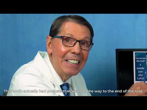 Dr. Tom Takes us Through a LANAP Case Study