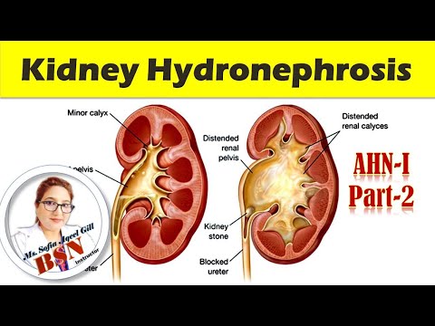 Hydronephrosis in Urdu & Hindi/AHN-1 for BsN