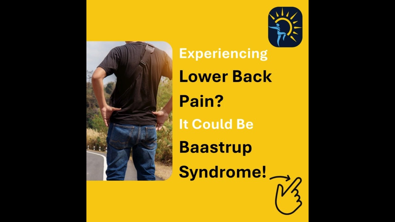 Experiencing back pain? It could be Baastrup Syndrome! Physiotherapy can help with pain relief! 💪