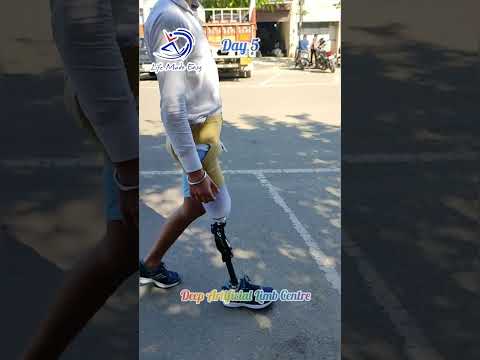 Artificial Leg Limb - Artificial Limbs Latest Price, Manufacturers ...