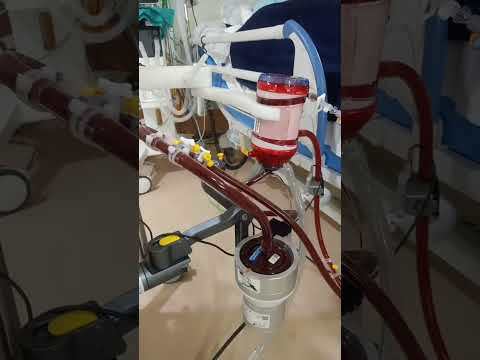 ECMO machine #hospital #medicalhealthcare #shorts #ecmo #ecmomachine #doctor #icudoctor #doctor