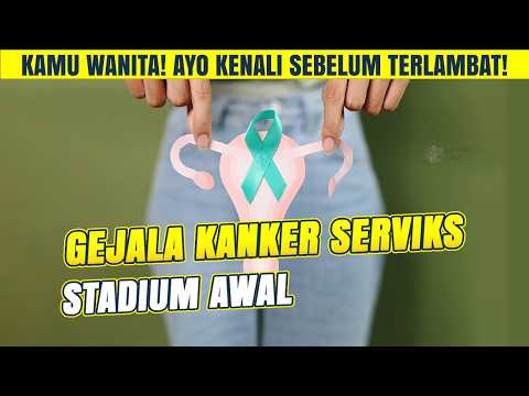 Waspada! Kenali Gejala Kanker Serviks Stadium Awal dan Cara Mencegahnya Sejak Dini!