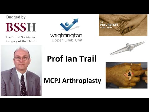 MCPJ Arthroplasty by Prof Ian Trail