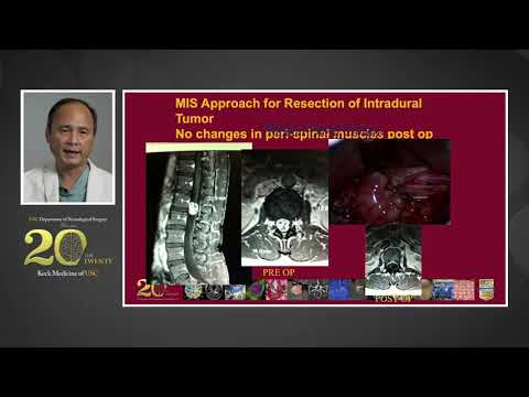 Contemporary Topics in Minimally Invasive Spine Surgery