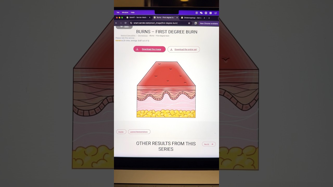 Find almost any medical images #medical #anatomy #images