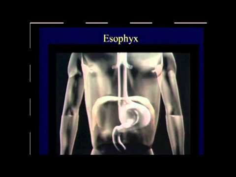 Endoscopy for Surgeons PG: Treatment of GERd, Barrett�s and Weight Loss