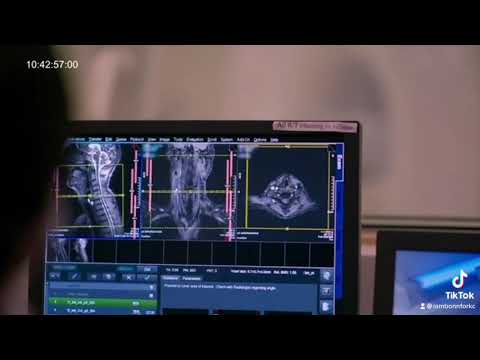 Super Surgeons: A Chance At Life. BBC Documentary on Channel 4 #bbc #uknurse #documentary #ofw