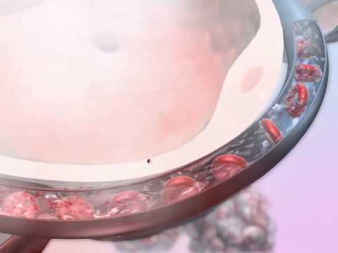 Capillaries in the Lungs: Learn@Visible Body