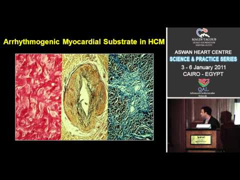 Basic principles, epidemiology, prevalence and diagnosis