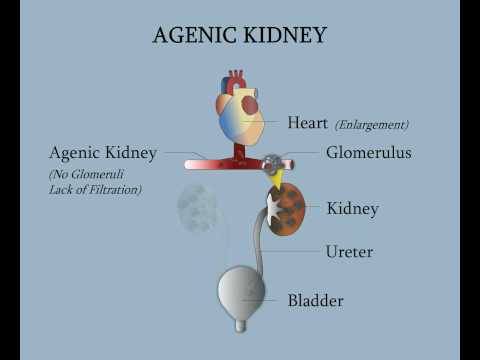 Agenic Kidney