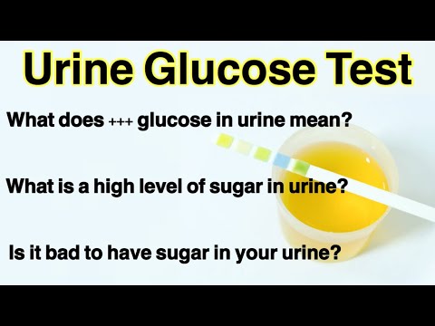 Urine Glucose Test In Urdu | Urine Tests for Diabetes |What does sugar in the urine mean|urine sugar