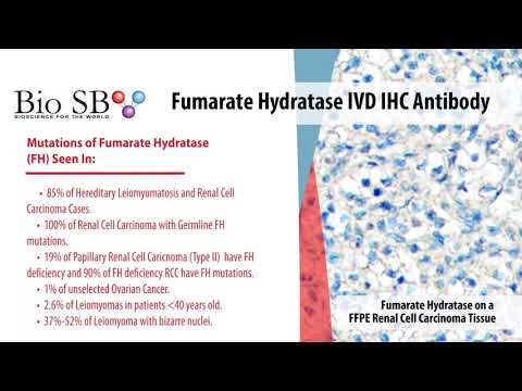 Bio SB - 2021 New Fumarate Hydratase Antibody for IHC