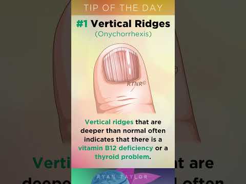 3 NAIL SIGNS Of HEALTH PROBLEMS