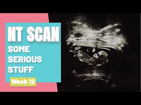 Nuchal Translucency Scan | nt Scan week 12 | What is nt scan | Why to have nt scan