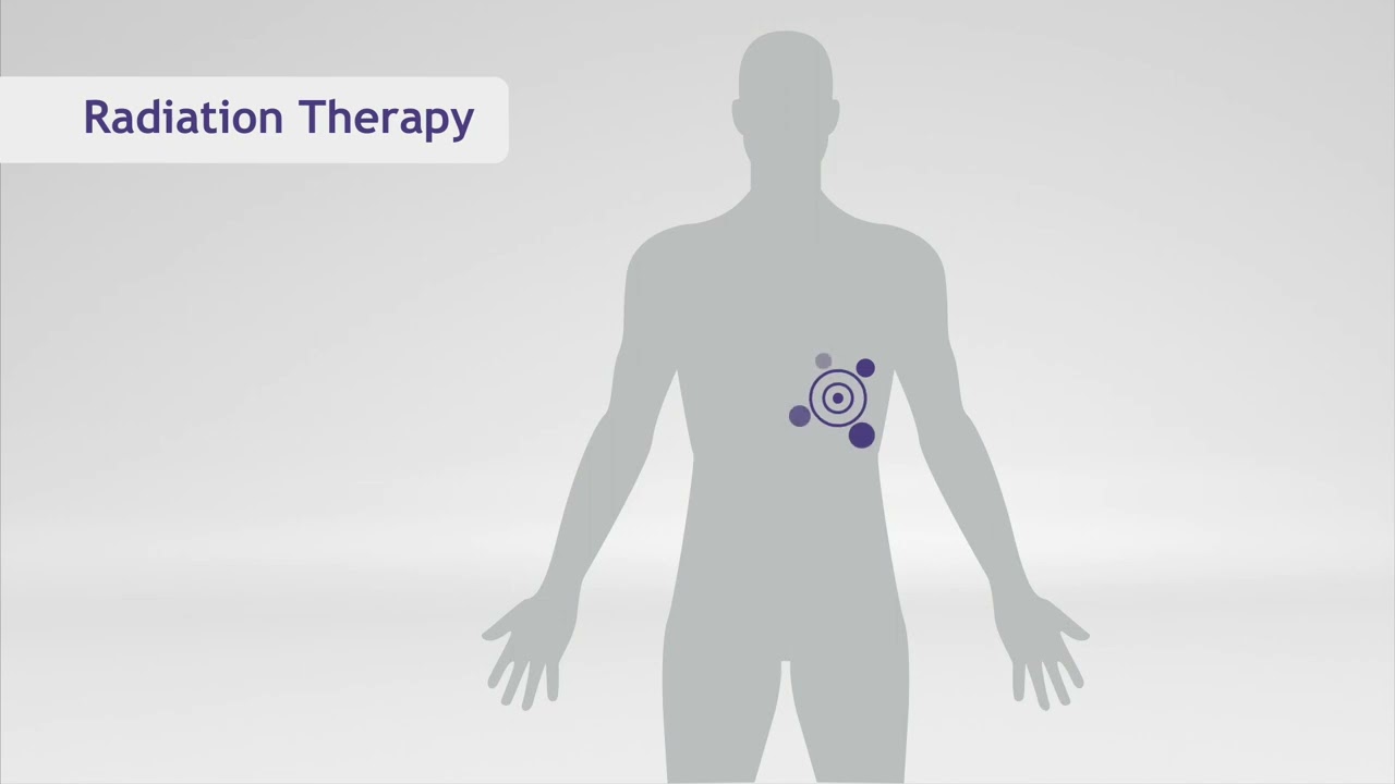 What's the Difference Between Chemo and Radiation? | SERO