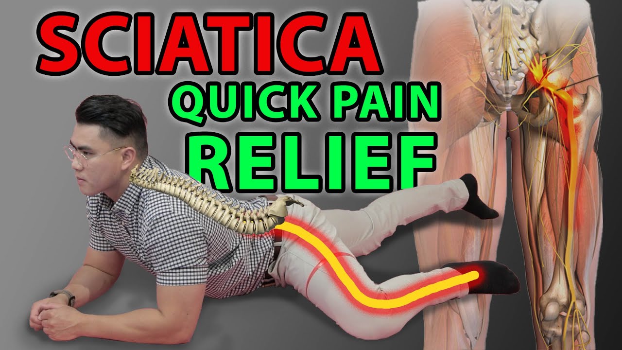 One Minute Sciatica Exercise to Cure Sciatica & Quick Pain Relief | Leg Pain Sciatica Disc Bulges