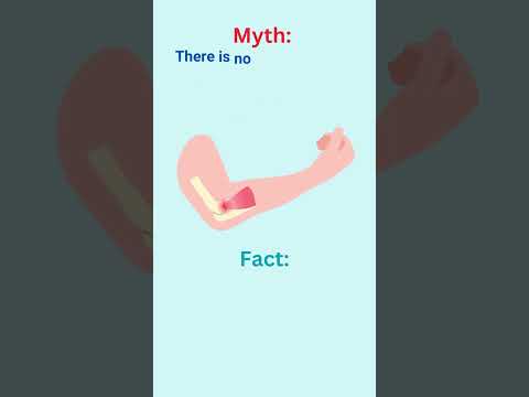Myths VS Facts Carpal Tunnel Syndrome
