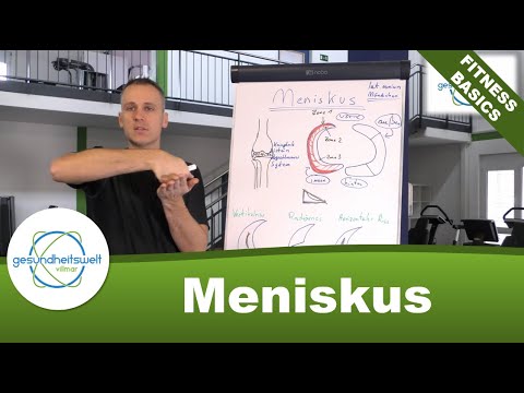 Meniskus Grundlagen - Was wann tun!