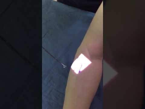 vein finder portable transilluminator