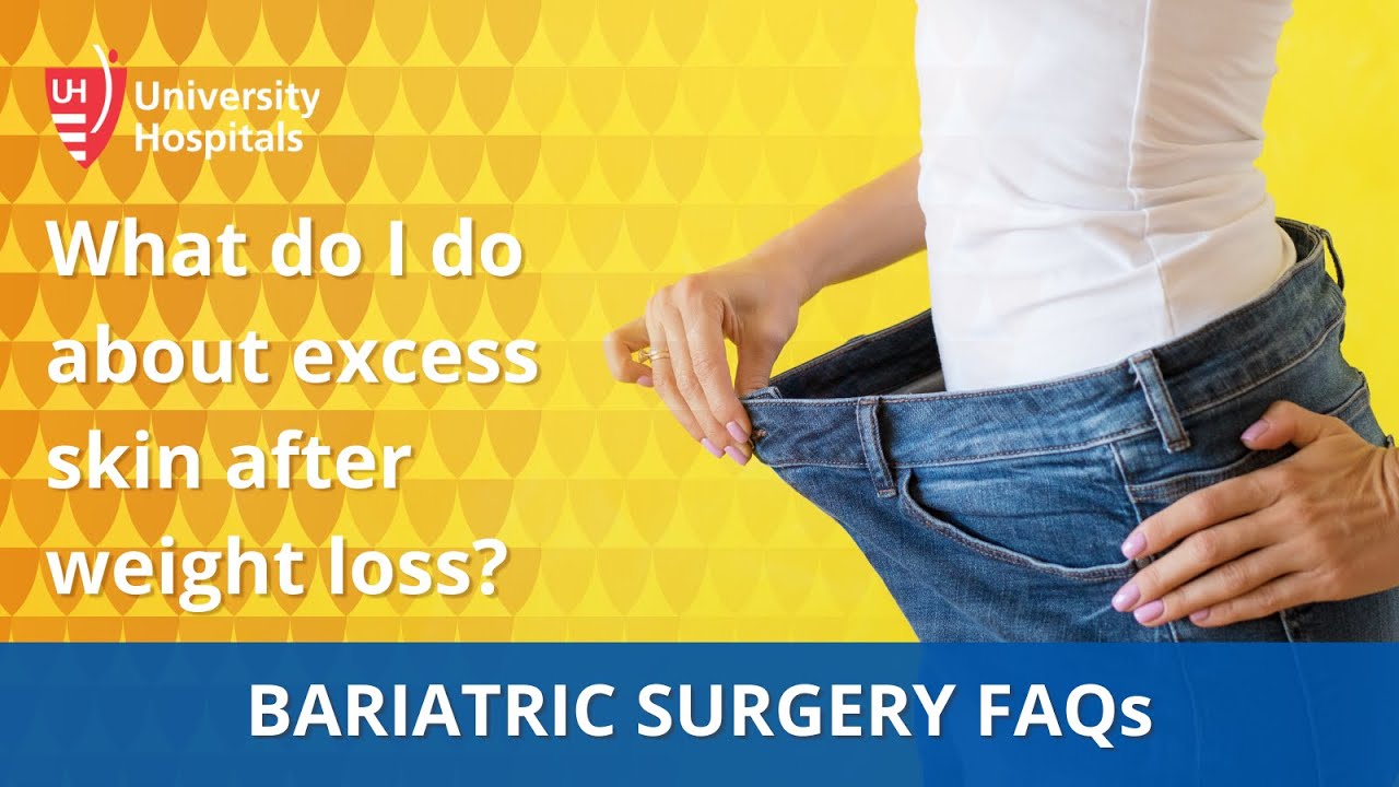 Bariatric Surgery FAQs - What do I do about excess skin after weight loss?