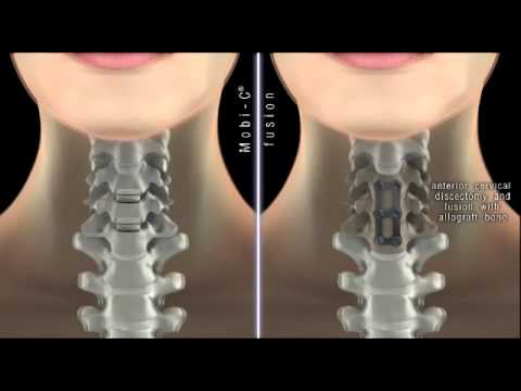 Symmetry Disc vs Fusion Animation Video — Two Level