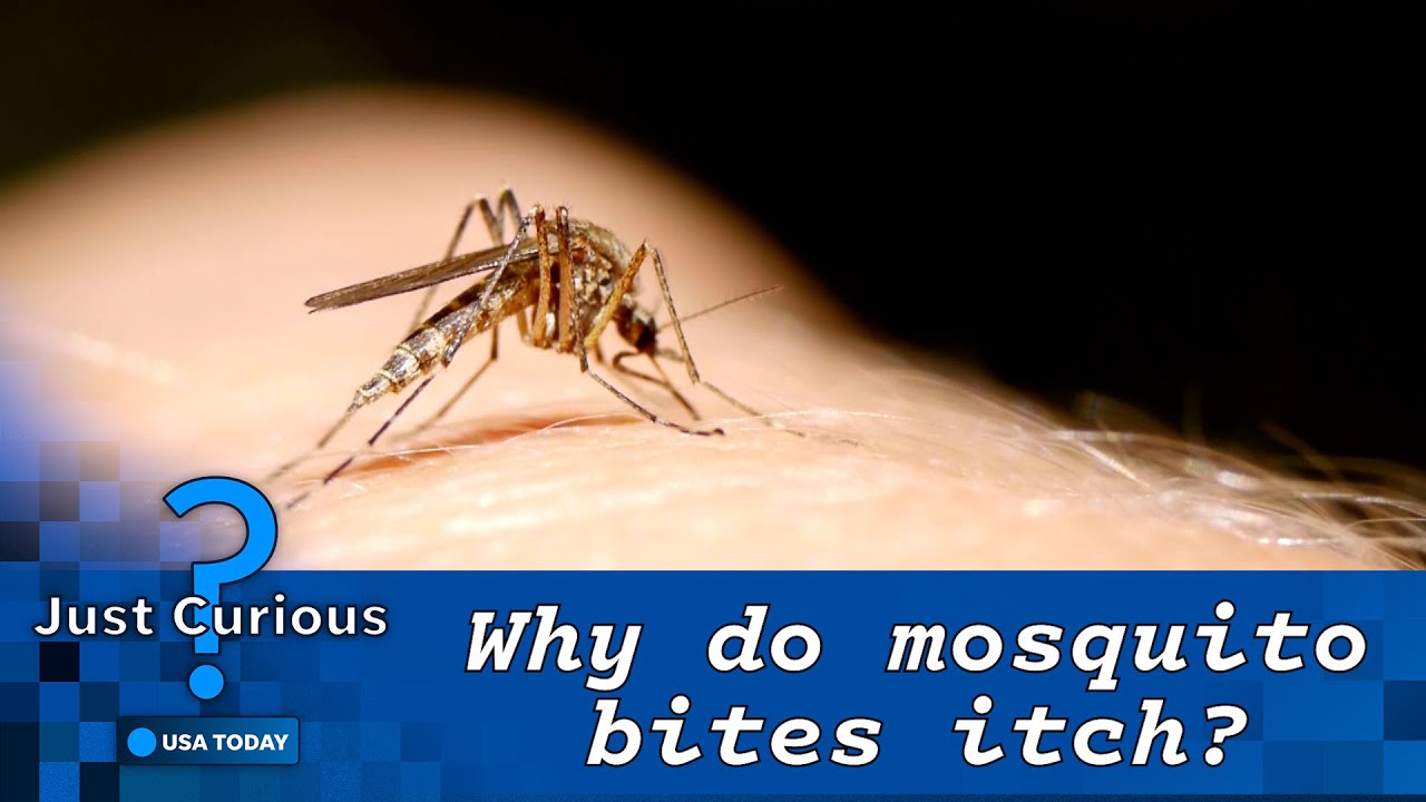 Why do mosquito bites itch? Here are the dangers of scratching | JUST CURIOUS
