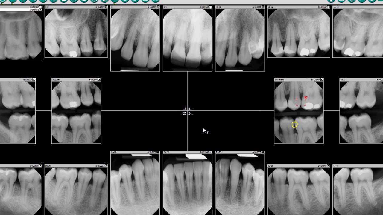 DEXIS™ Imaging Suite - Patient Screen Overview