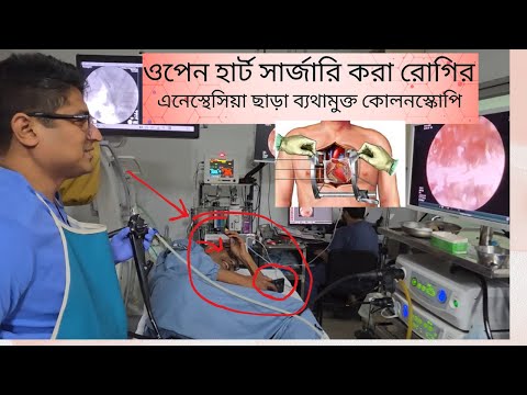 স্পেশালাইজ ইন্টারভেনশন এন্ডোস্কপি ইউনিট Specialized Intervention ...