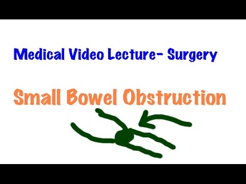 Medical Video Lecture, Surgery: Small Bowel Obstruction SBO