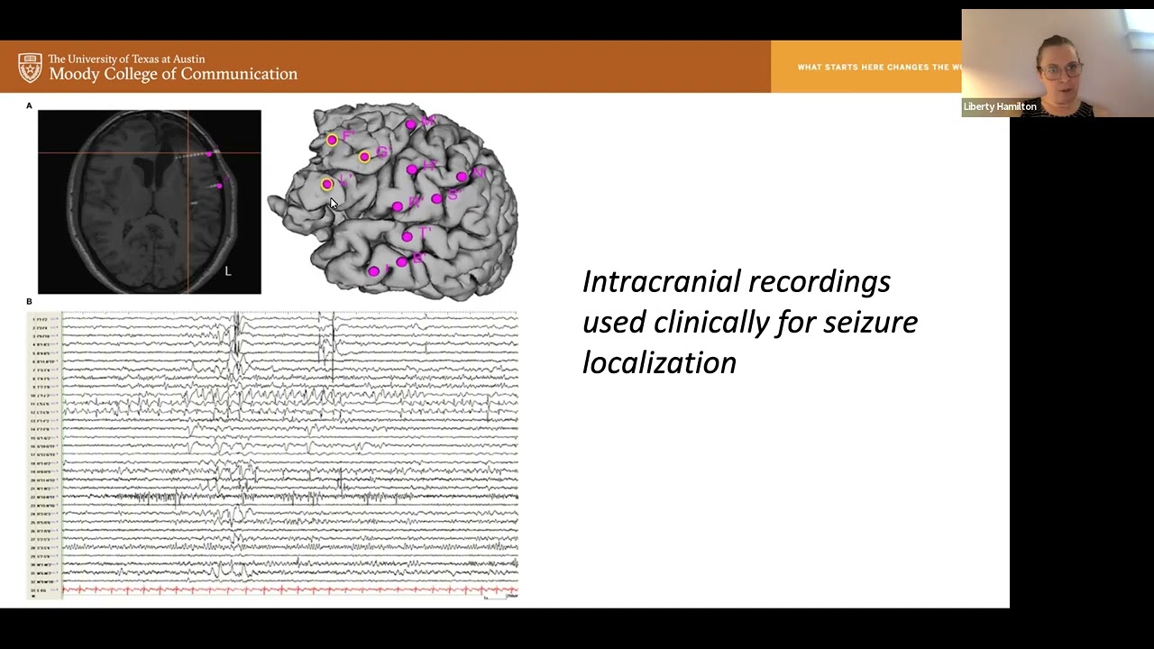 NeuroHackademy 2022: Liberty Hamilton - Processing intracranial data with MNE-python