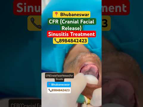 CFR; Cranial Facial Release)used to Treat sinusitis 📍 Bhubaneswar📞8984842423 #cfr #chiropractor
