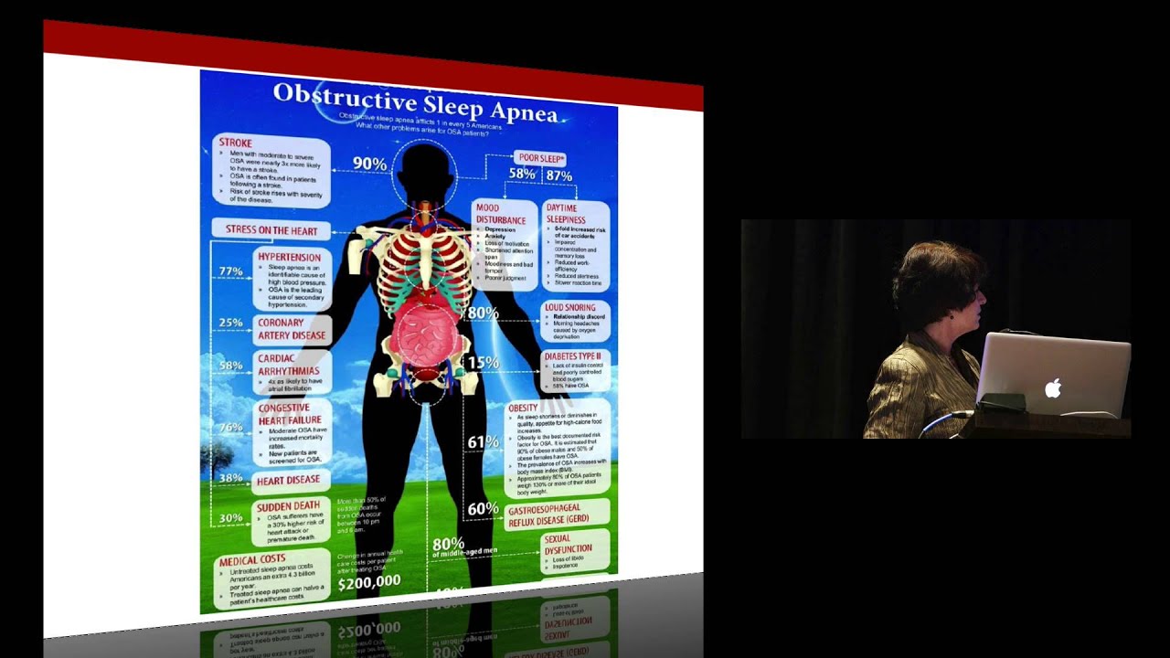 OSA: Implications, Assessment   and Guidelines