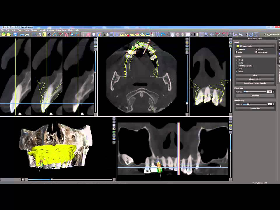 BSP Step by Step Tutorial