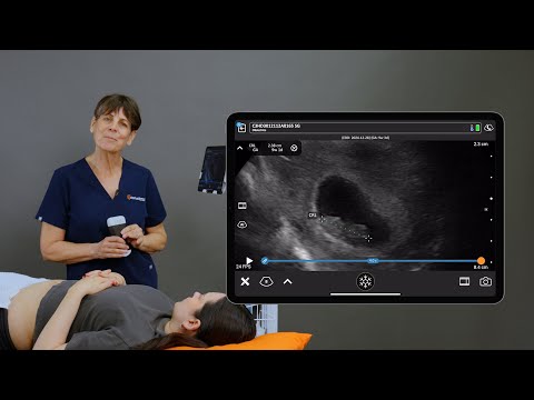 Crown Rump Length CRL Measurement