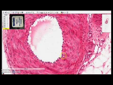Simple Squamous Epithelium