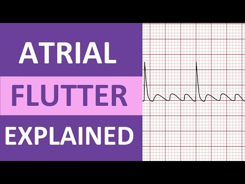 Atrial Flutter (a-flutter) ECG/EKG Nursing Review