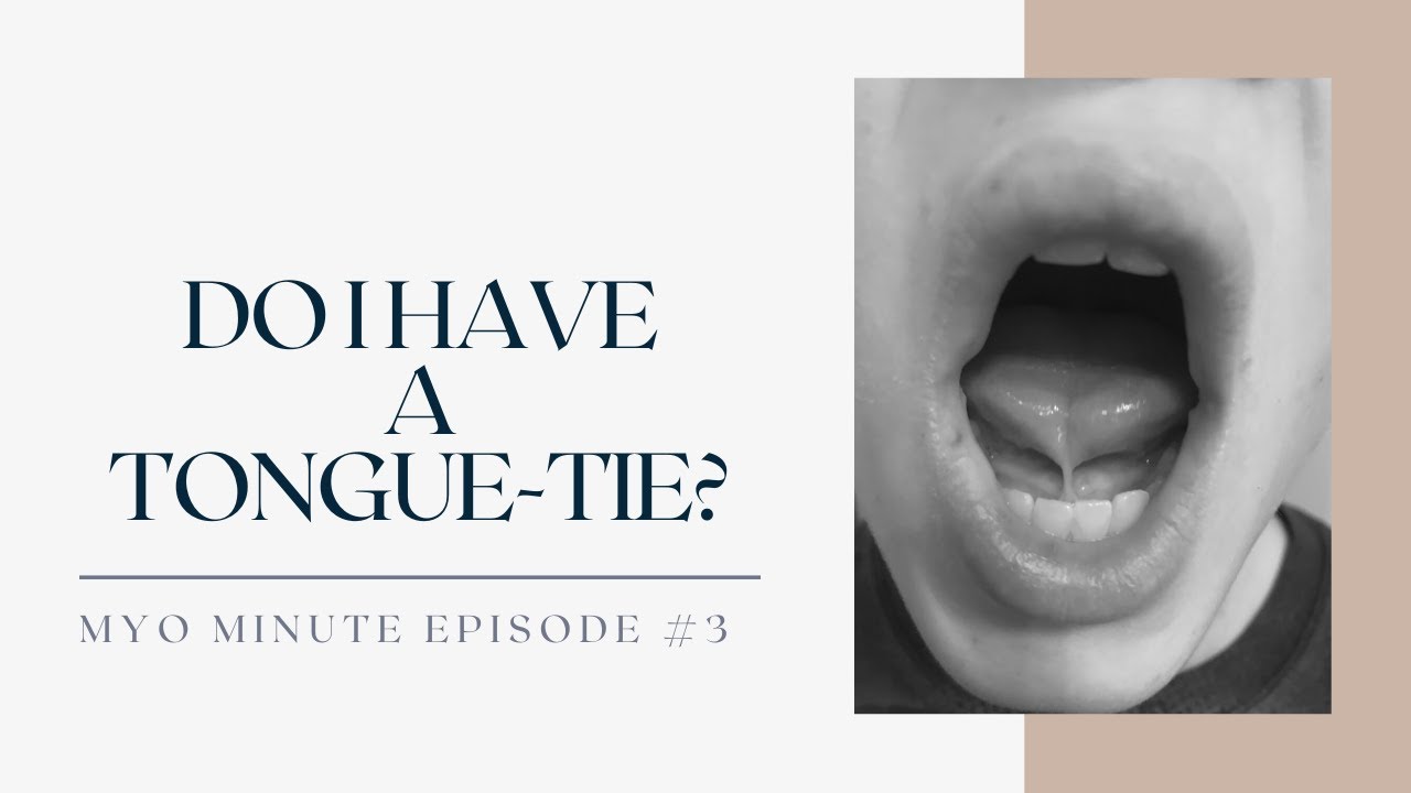Myo Minute Episode #3: Do I Have a Tongue-Tie?