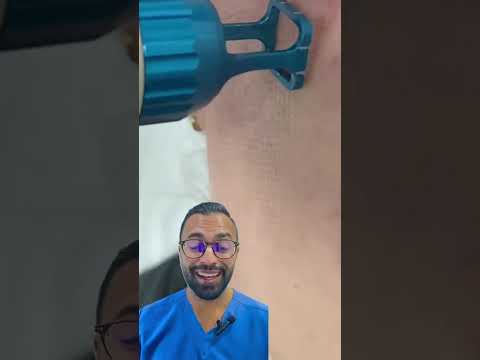 Doctor explains how to treat STRETCH MARKS | Dr. Medispa