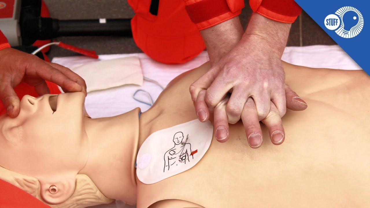 CPR: Where did it come from? | Stuff of Genius