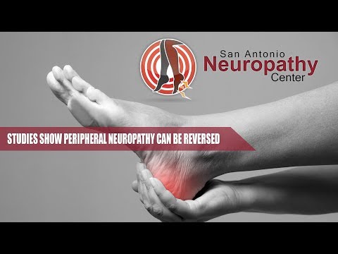 Educational Peripheral Neuropathy Video