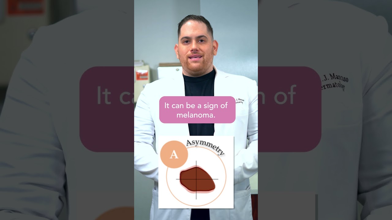 Dermatologist explains the ABCDE rule for detecting melanoma